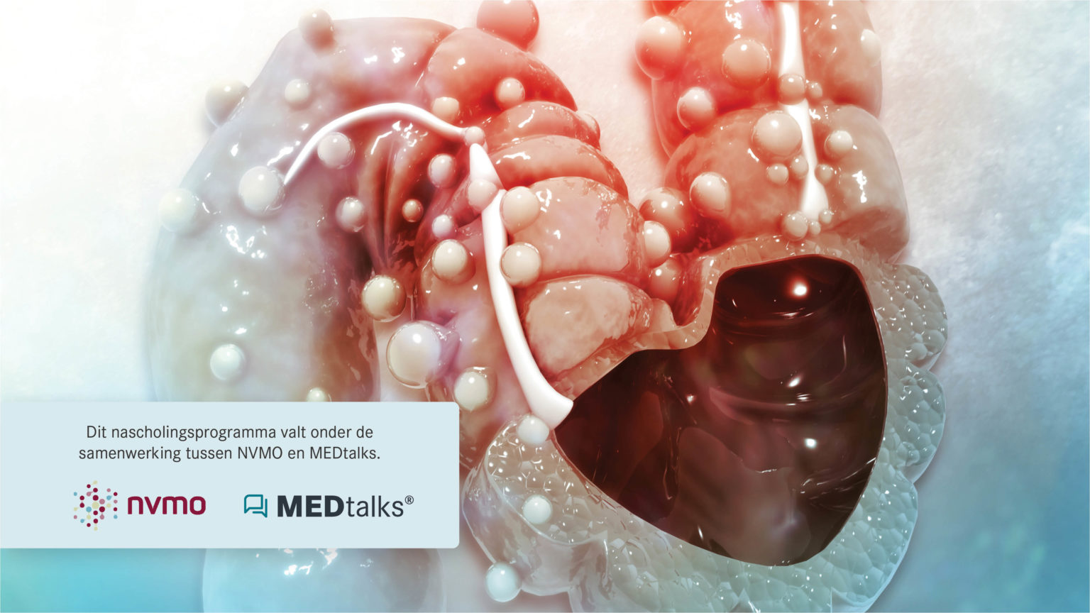 Colorectaal Carcinoom Update 2022 - NVMO